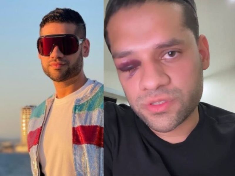 Alan Zamudio: integrante de mi Banda el Mexicano aparece con el ojo ...